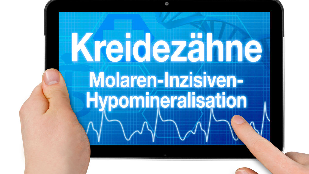 Kreidezähne (MIH): Ursachen, Symptome & Behandlung | DENTAL & WIRTSCHAFT